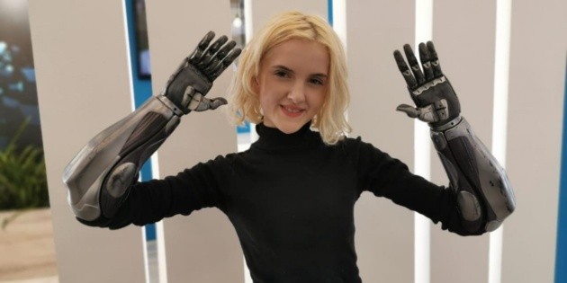 Tilly Lockey, una adolescente con brazos biónicos | El Informador