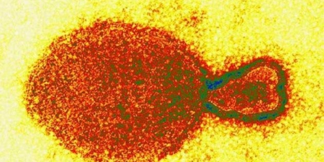 Henipavirus: Esto es lo que sabemos del nuevo virus de China | El ...