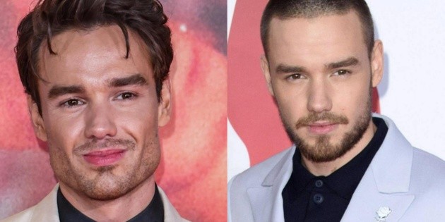 Liam Payne: ¿Se operó? Ex integrante de One Direction impacta con su ...