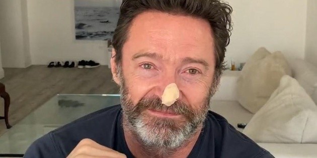 Hugh Jackman: la imagen con la que el actor muestra que se sometió a ...