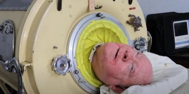 ¿Quién fue Paul Alexander, hombre que vivió 70 años en un pulmón de ...